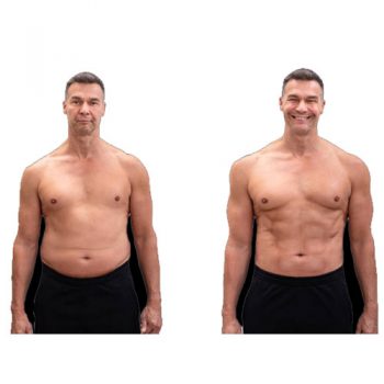 Revamp Your Look with a Mommy Makeover and BBL Combo